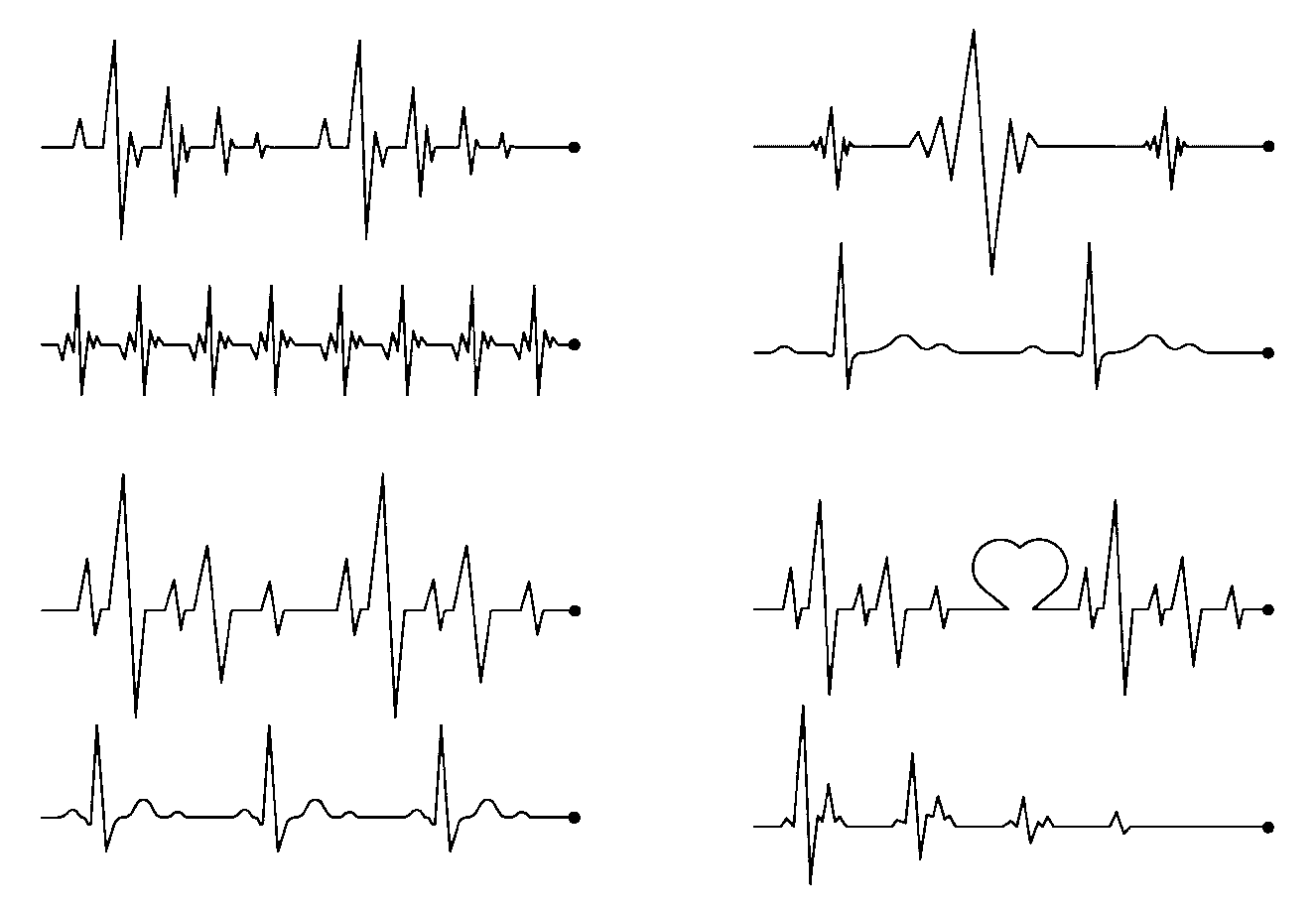 HD Red Collection Of Heart Rate Lines PNG | Citypng